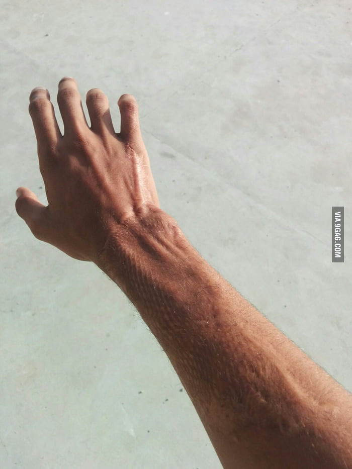 My scar everyone - 9GAG