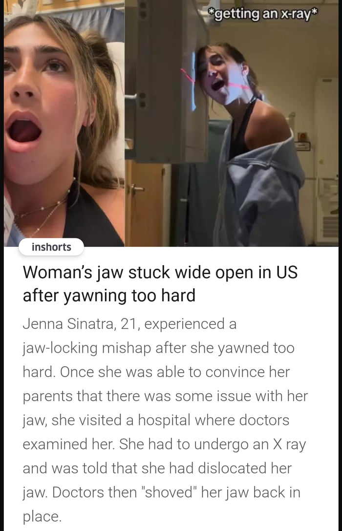 We all know it wasn't stuck because of yawning - 9GAG