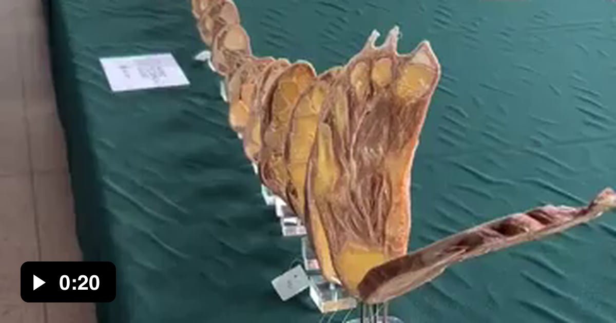 Sliced human body at the Museum of Life Sciences in Brazil - 9GAG