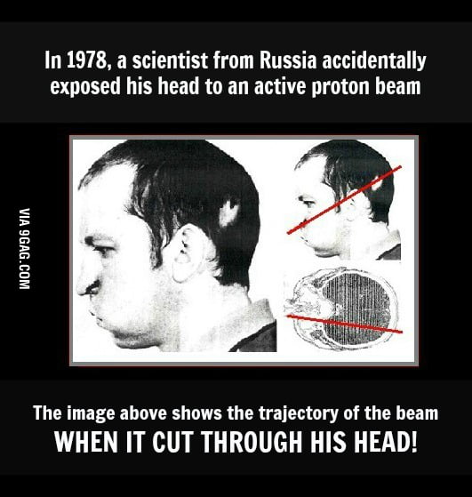 Anatoli Bugorski, He's still alive.. - 9GAG