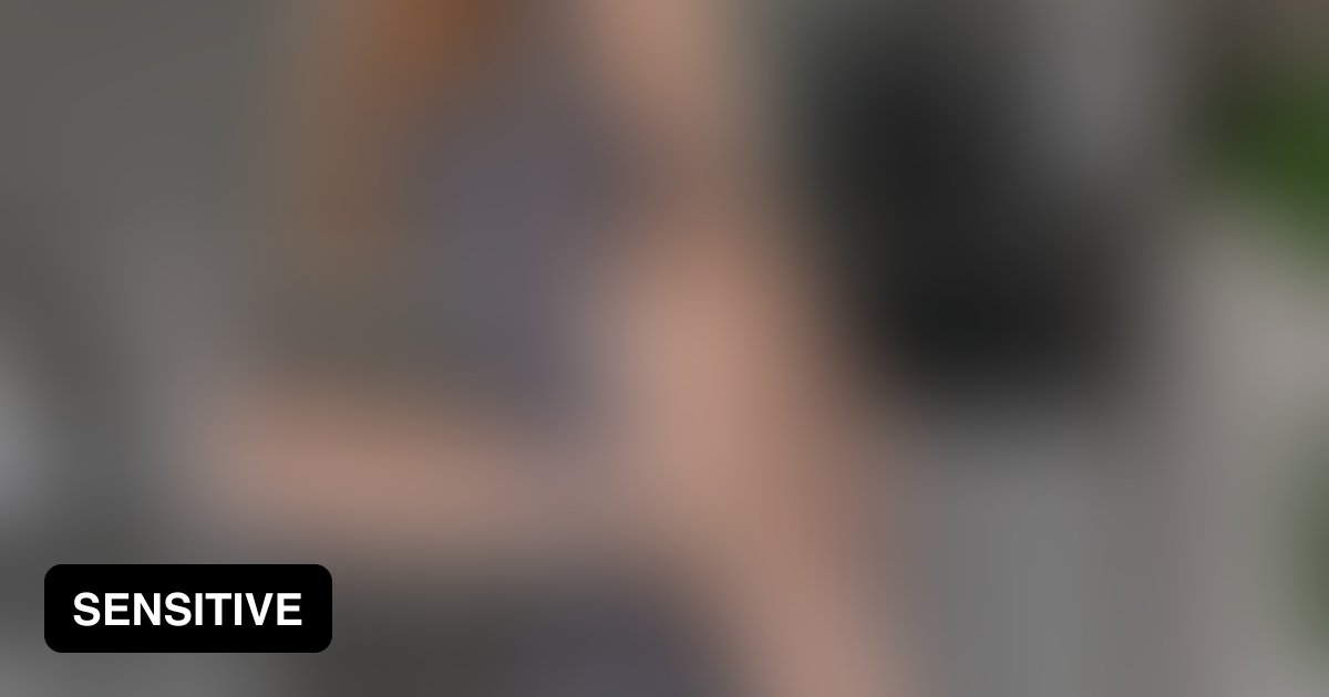 Freckle/nice leg - 9GAG