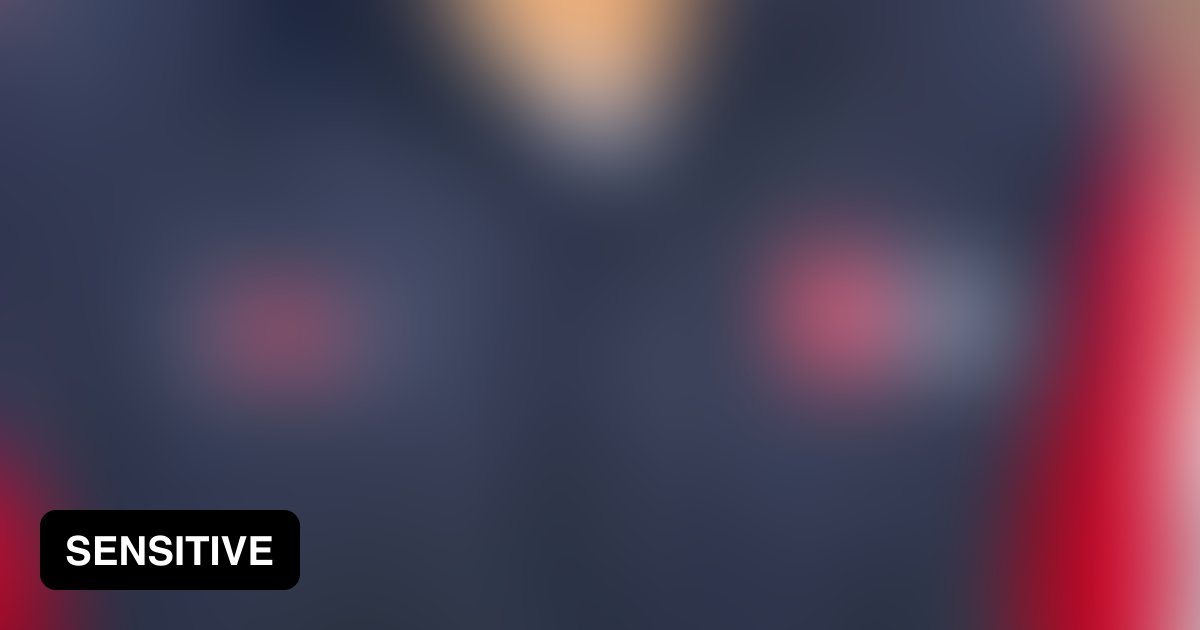 (The Bone Museum) Taking a look at Optic Glioma. - 9GAG