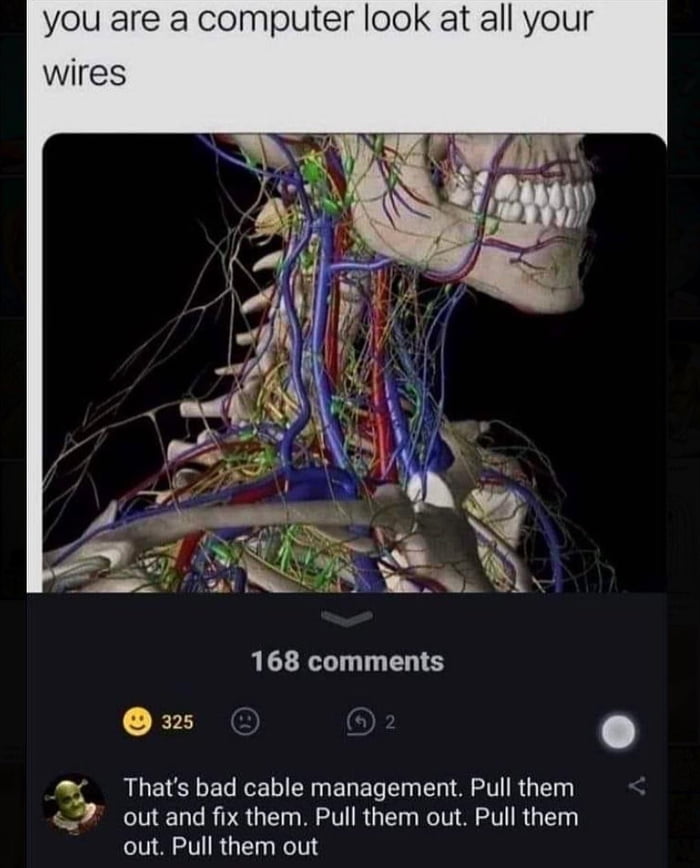 My internal wiring needs some serious cable management - 9GAG