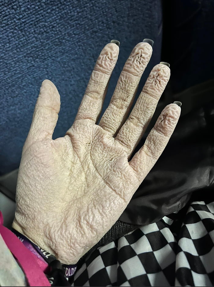 These extremely wrinkled hands. - 9GAG