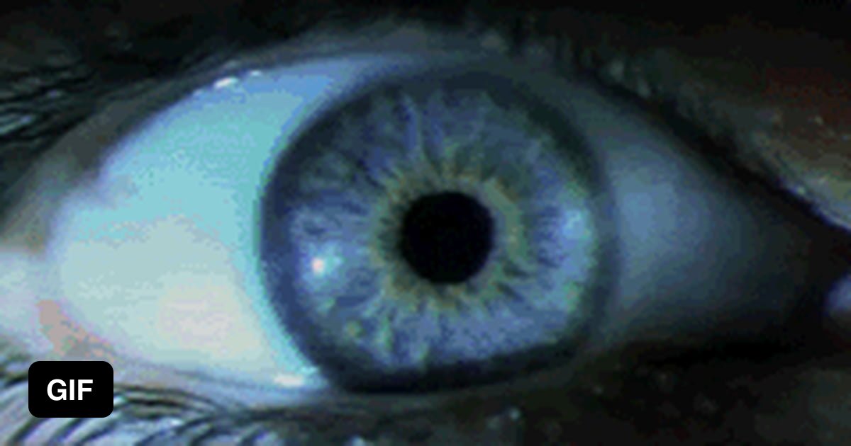 Cybernetic Eye - 9GAG