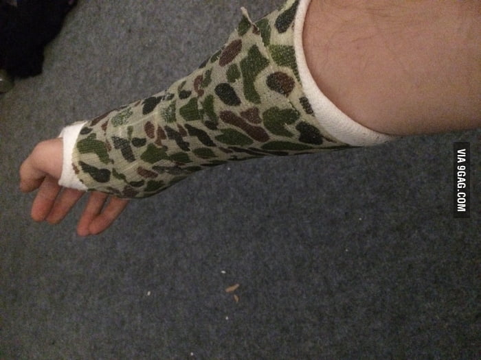 Just lost my arm in an accident - 9GAG