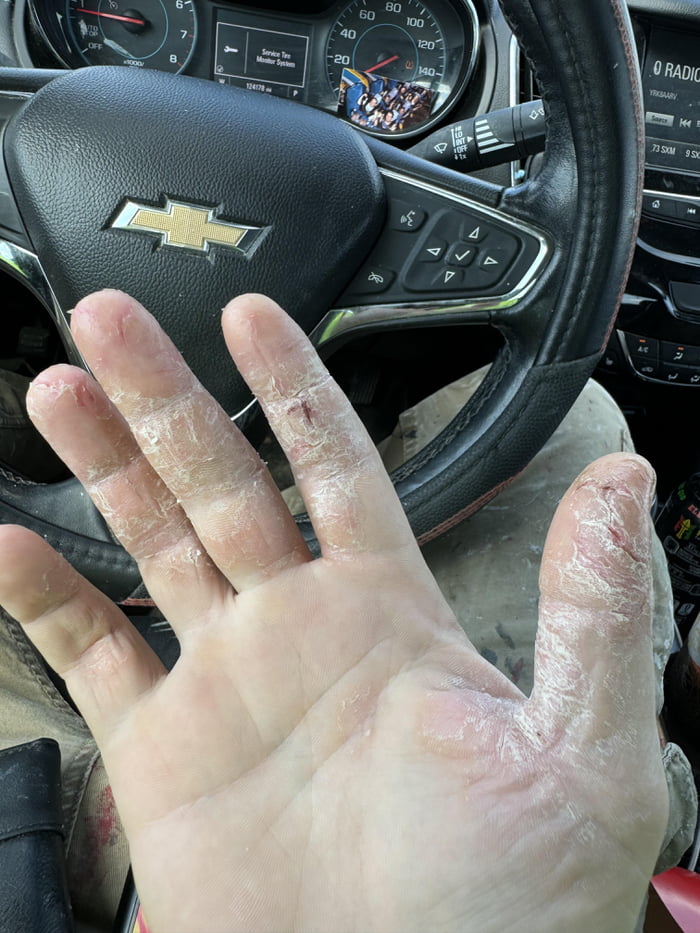 Never take the skin on your hands for granted - 9GAG