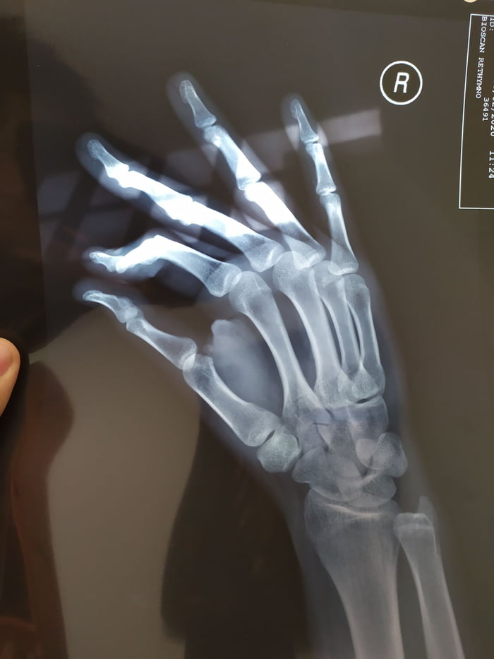 When the doctor tells you to stay still , but you can't resist . My ...