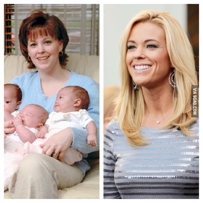 Kate Gosselin From Jon And Kate Plus 8 Before And After Money Started Pouring In 9gag
