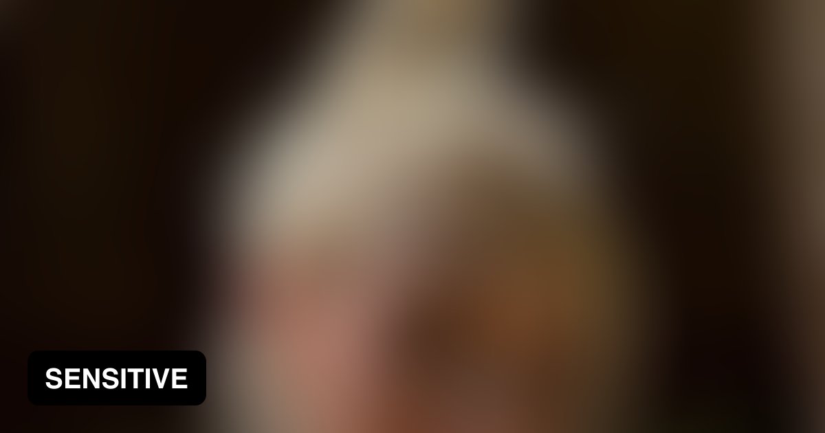 Sexy Stretch Marks - 9GAG