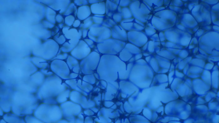 This is a Magic Eraser under a microscope - 9GAG