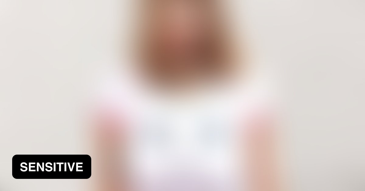 Very puffy cheeks - 9GAG