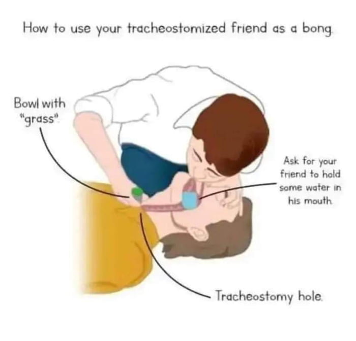 Yoo bro pass my Timmy - 9GAG